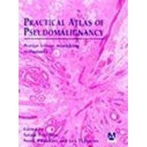 Practical Atlas of Pseudomalignancy: Benign Lesions Mimicking ...