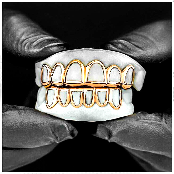 Custom Fit Open Face 14K Gold Plated Mouth Teeth Grills Grillz Upper ...