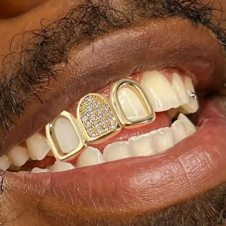 Custom Fit 14k Gold Plated Iced Bling Mouth Open Face 3 Tooth Cap Teeth ...