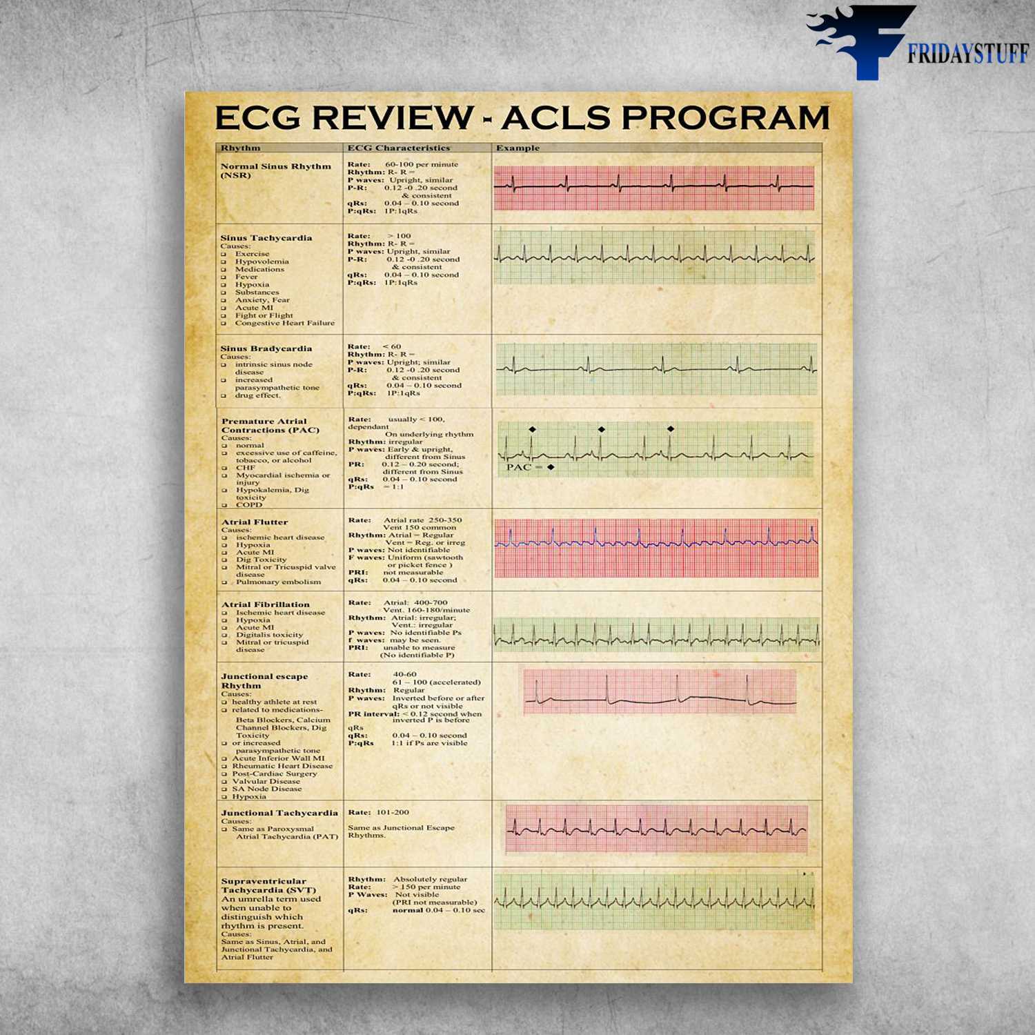 ECG Review ACLS Program Electrocardiogram Knowledge Advanced ...