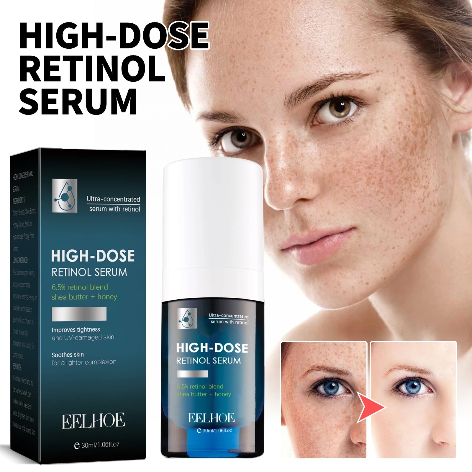Retinol Facial Serum Reduce Fine Lines Acne Fade Color Spots Melasma ...