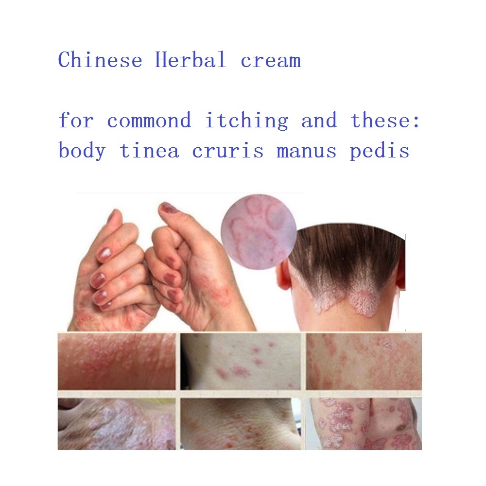 2BOX Skin problems care for Psoriasis eczema dermatitis ointment 7g/box ...