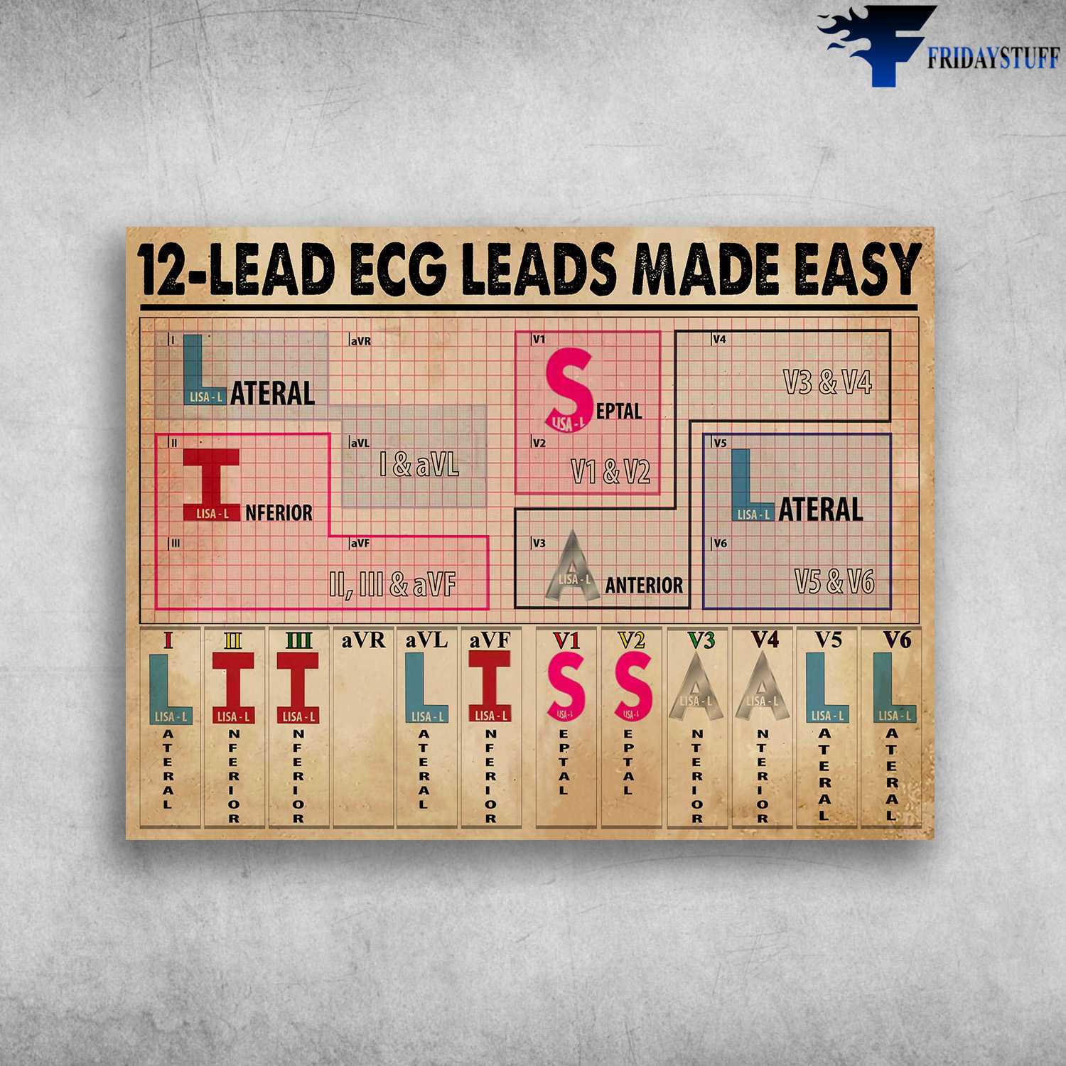 12 Lead Ecg Leads Made Easy Lateral Septal Inferior Anterior Lateral ...